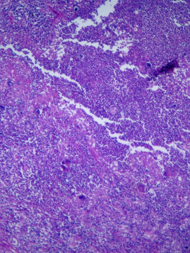 A deadly fungal disease on the rise in the West has experts worried | Grist