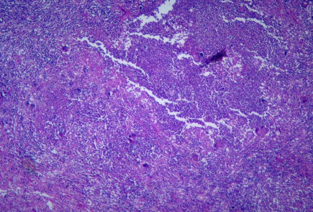 A deadly fungal disease on the rise in the West has experts worried | Grist