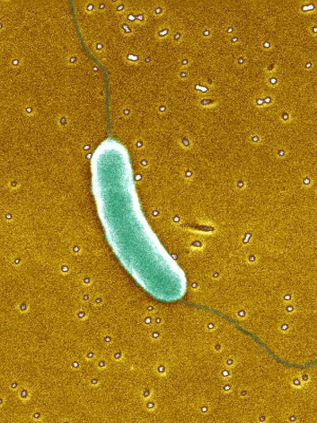 Hurricane Ian stirred up flesh-eating bacteria in Florida | Grist